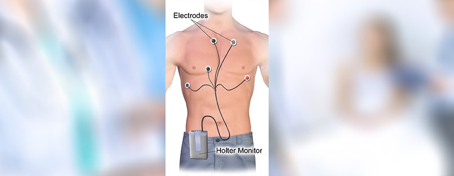 Holter Monitoring | Griffin Health