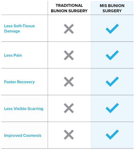 Minimally Invasive Bunion Surgery in Derby, Connecticut
