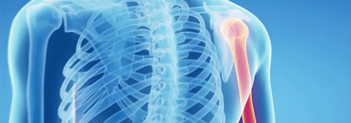 Though Common, Not All Dislocated Shoulders Are the Same | Griffin Health