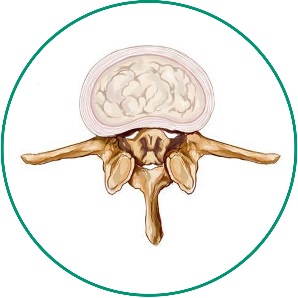 Minimally-Invasive Lower Back Surgery | Griffin Health